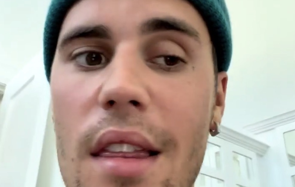 Justin Bieber Reveals He Has Facial Paralysis Due to Ramsay Hunt ...